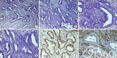 复层柱状上皮图形复层柱状上皮图片复层柱状上皮模式图第2页大山谷图库