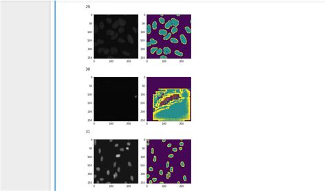 dynamic unet part 2 and alumni 2018 deep learning course forums