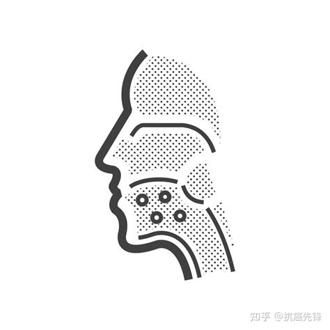 为什么头颈鳞癌多数发现即为晚期？ 知乎