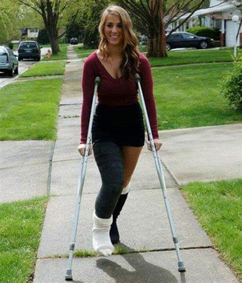 Collection 99 Pictures Women Slc Leg Cast Pictures Updated
