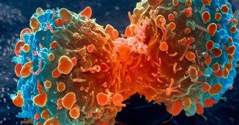 What Is Cancer Care Online