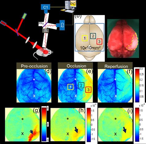 Figure From Fast Synchronized Dual Wavelength Laser Speckle Imaging
