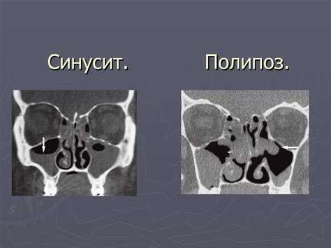Компьютерная томография в диагностике заболеваний и опухолей лицевой