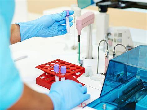 Inappropriate Test Orders Inundate Health Systems