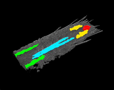 Neural Network Filters Weak And Strong External Stimuli To Help Brain
