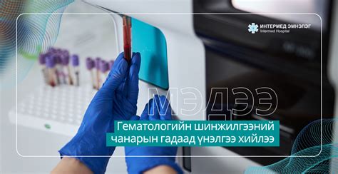 Гематологийн шинжилгээний чанарын гадаад үнэлгээ хийлээ Intermed