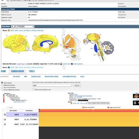 Differences In Z Score Values For The Same Region Same Donor And Same