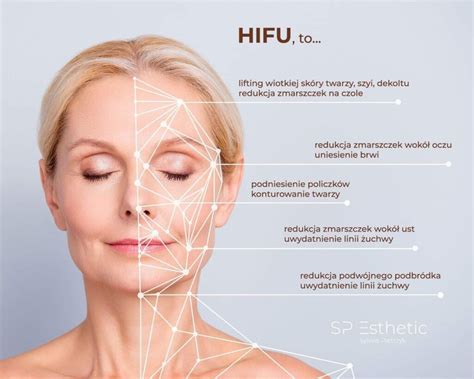 HIFU Lifting Twarzy Na 2025 R SP Esthetic Sylwia Pietrzyk Gliwice
