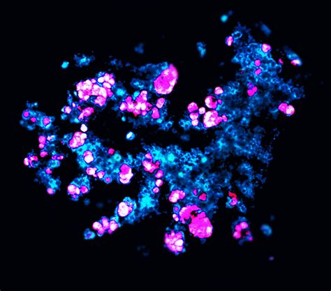 Heterogenous Lung Organoids Prototypes For Humanity