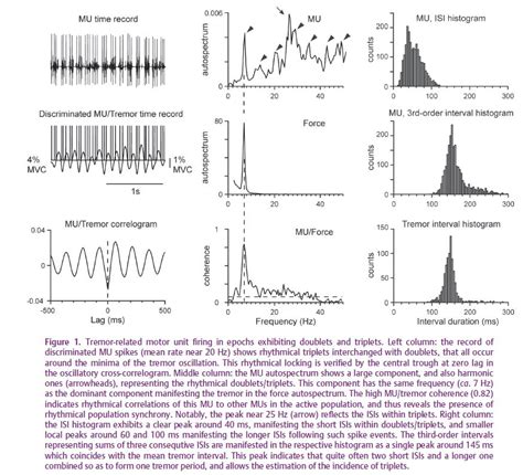 Analyses Of Motor Unit Firing Patterns And Synchrony Contribute To Our Understanding Of Tremor