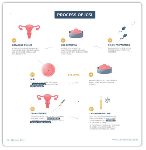 IVF ICSI Andromedi
