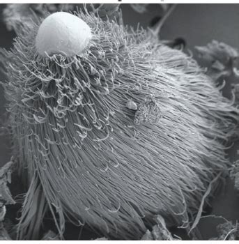 Microbiology Eukaryotes Part Flashcards Quizlet