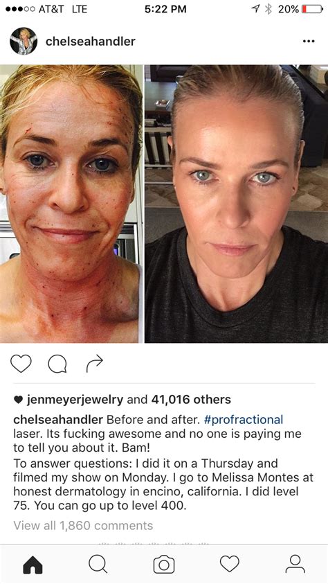 Pin By Kelsey Newell On Beauty Laser Skin Treatment Laser Facial
