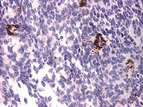 A Detail Showing The Specificity Of The Immunostaining For
