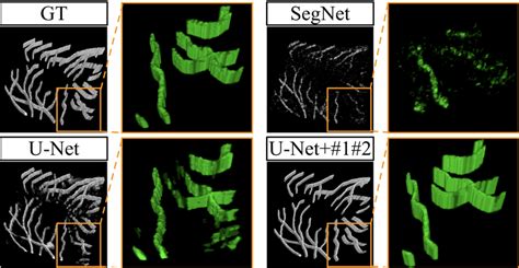 Qualitative Comparison Of The 3d Segmentation Results Gt Is The Ground Download Scientific
