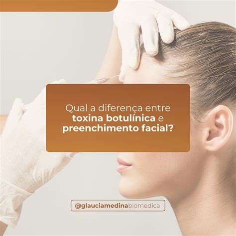 Você sabe qual a diferença entre toxina botulínica e preenchimento