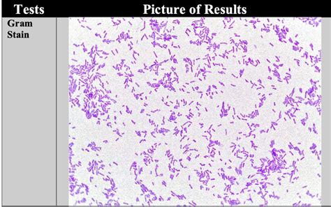 Solved Your Unknown Bacteria Sample Is One Of The Following Species