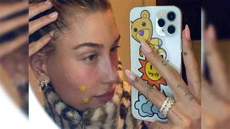 Are Pimple Patches Bad For Your Skin Heres What We Know Lifestyle News Times Now