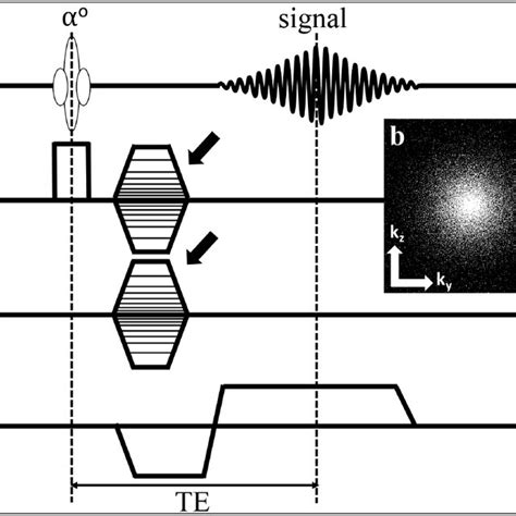 The Cs Reconstruction Phase And Qsm Images With B F And Without C