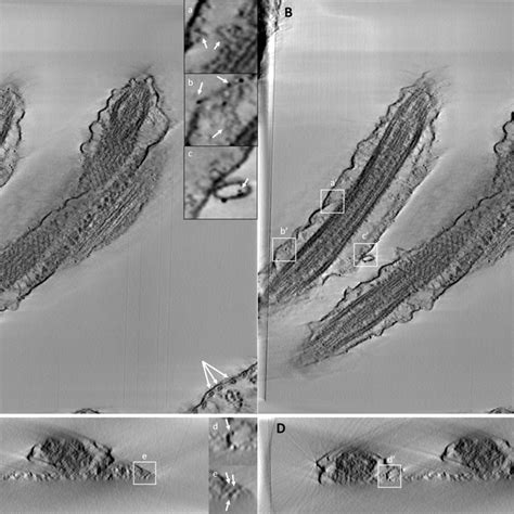 Comparison Of The Reconstructions Of The Phantom With The Different Download Scientific Diagram