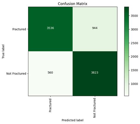 Prithivmlmods Bone Fracture Detection · Hugging Face