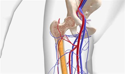 Premium Photo The Multiple Myeloma Bone Disease