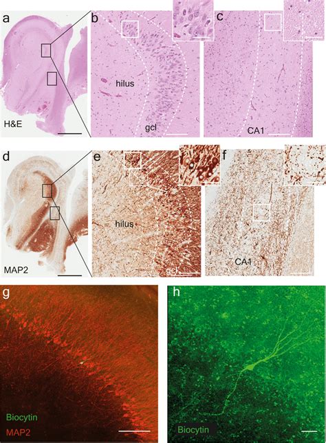 Neuropathological Evaluation And Granule Cell Layer With Download