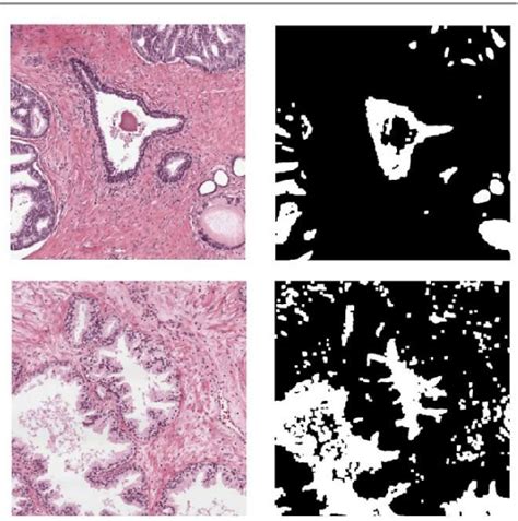 Figure 1 From A Novel Attention Based Model For Semantic Segmentation