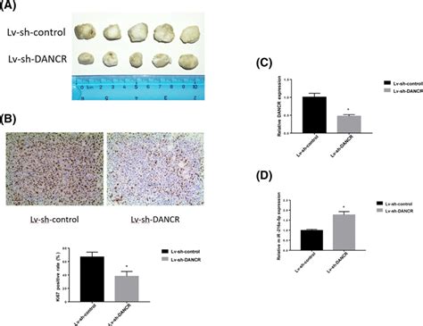 Down Regulation DANCR Inhibited Tumor Progression In Vivo A The Tumor
