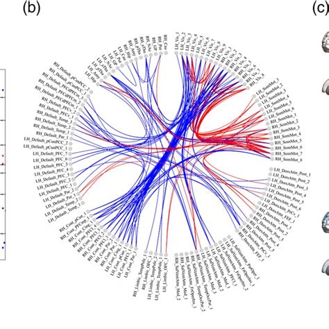 Network‐based Analysis Of Structural Connectome Between Patients With
