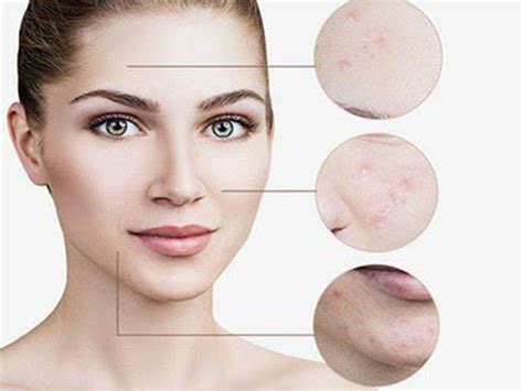Chemical Peel NewYou Skin And Body