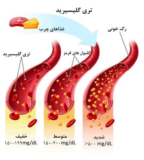 تری گلیسیرید آزمایشگاه پاتوبیولوژی آرمین بیماری های گوارشی آزمایش خون