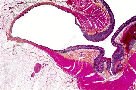 Diverticulum Light Micrograph Stock Image C021 3113 Science Photo Library