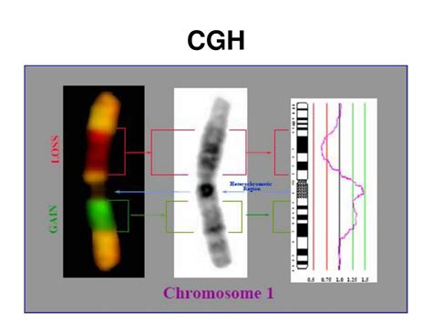 Ppt Microdeletion Syndromes Powerpoint Presentation Free Download