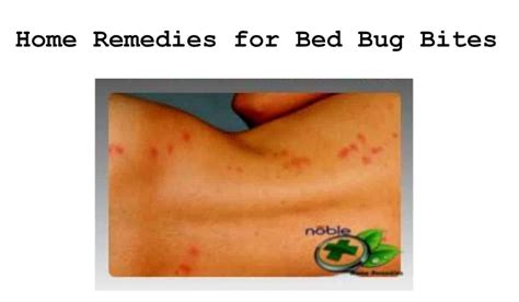 How To Get Rid Of Bed Bug Bites Overnight Top 5 Remedies