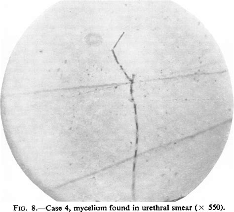 Figure 2 From Non Specific Urethritis Semantic Scholar