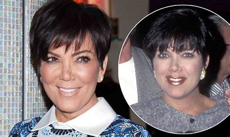 Kris Kardashian Nose Job Before And After