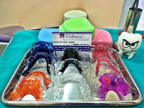 คลินิกทันตกรรมบ้านยิ้มสวย เพชรบุรี จัดฟัน ทำฟัน วีเนียร์