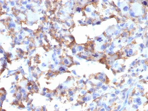Cd163 Monocyte And Macrophage Marker Antibody Clone M1302163 Gene