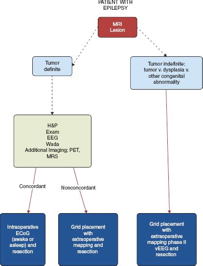 Epilepsy Surgery Neupsy Key