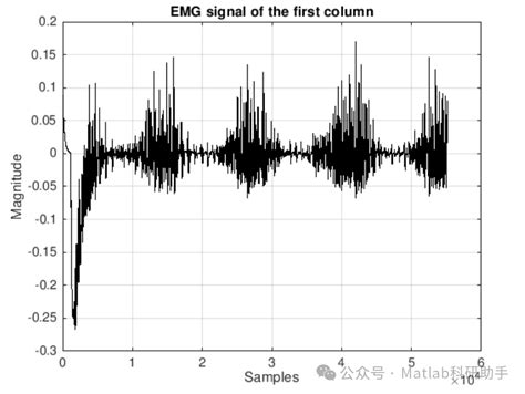 【数字化处理】仿生假体控制中肌电信号的数字化处理研究附matlab代码 csdn博客