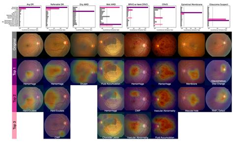 Use Cases Of Counterfactual Attribution Ratio In Diagnostic Fundus Download Scientific Diagram