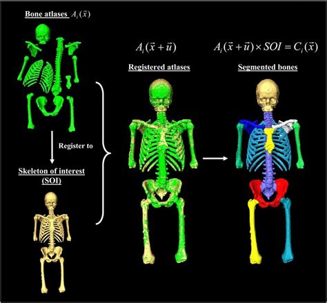 Workflow Of Atlas Based Segmentation Left To Right The Atlases