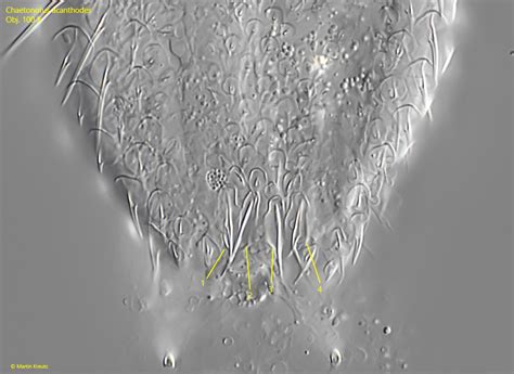 Chaetonotus Acanthodes Real Micro Life