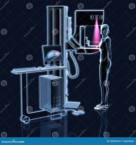 Mammography Breast Cancer Screening 3d Illustration Stock
