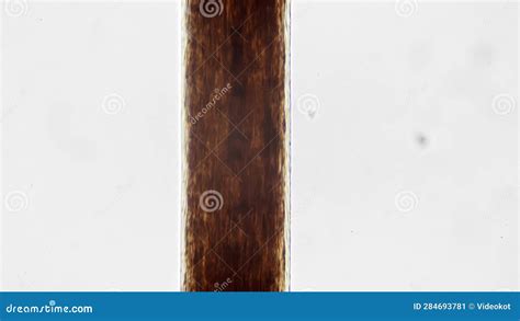 Whole Mount Of Human Hair Filmed Under Microscope 400x On Bright Field
