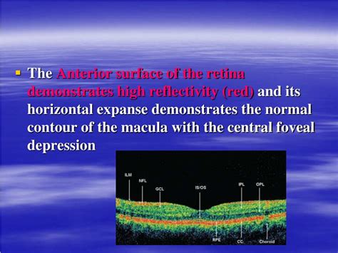 PPT Oct Interpretation PowerPoint Presentation Free Download ID 5284411