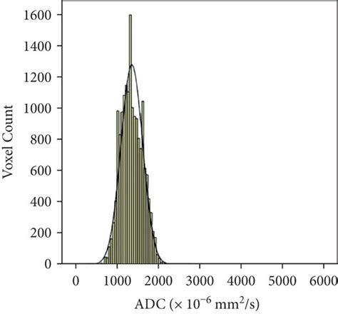 Freehand Segmentation Of Idh Wild Lgg A The Roi Entire Tumor Roi