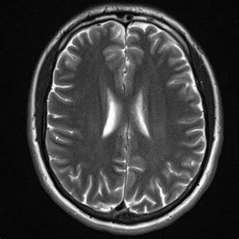 Cjd The Caretaker Fan Projects Wiki Cjd The Caretaker Fan Projects Wiki