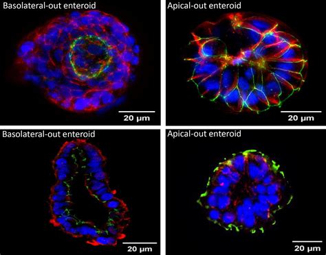 Apical Out Enteroids As An Innovative Model For Necrotizing